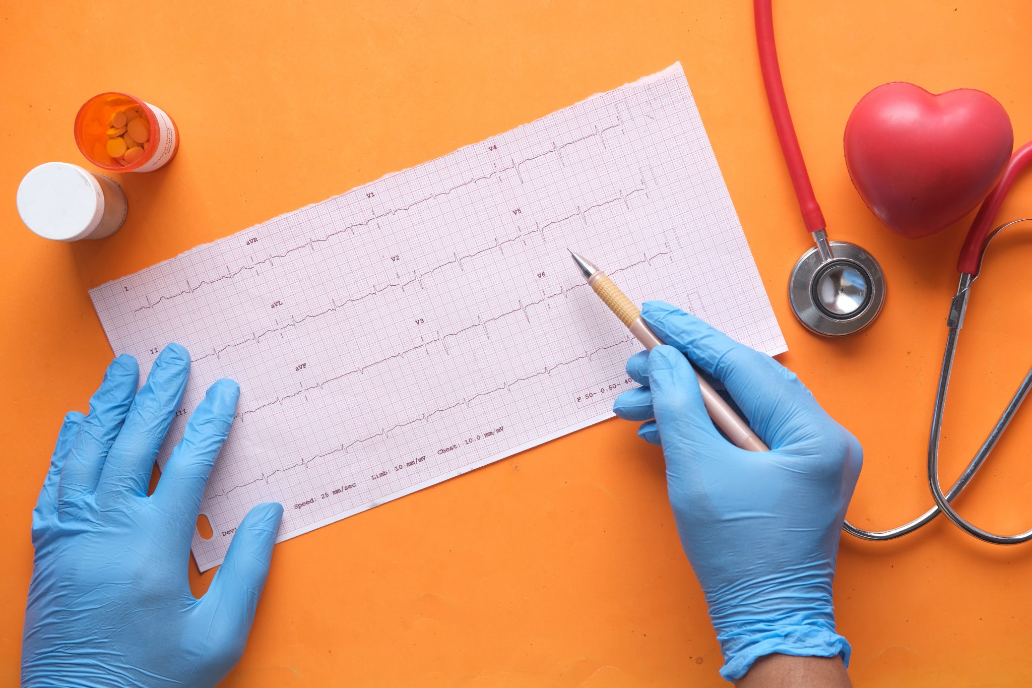 Cardiovascular History Translational Cardiovascular Research Group Cardiovascular History Translational Cardiovascular Research Group