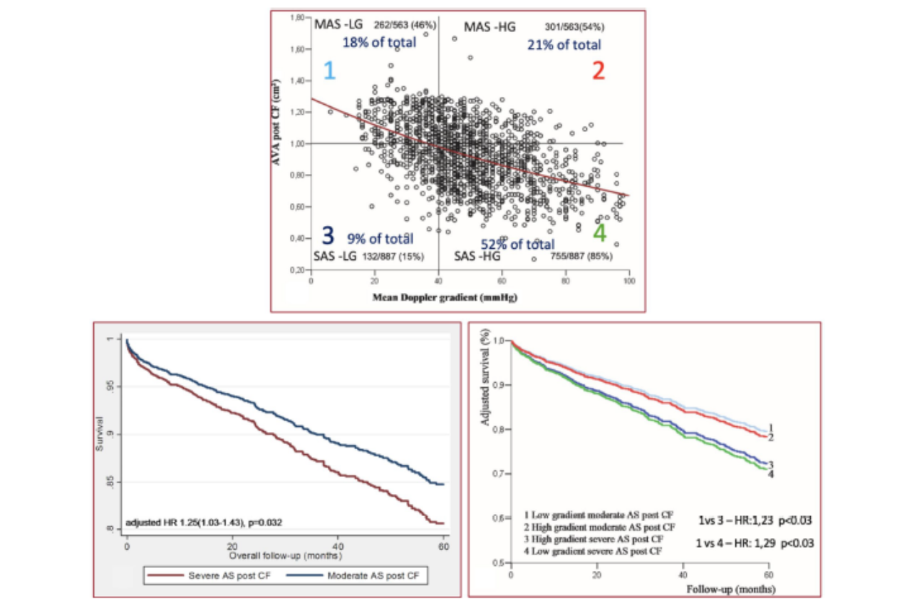 Simplified Grading to Streamline Management - Translational ...